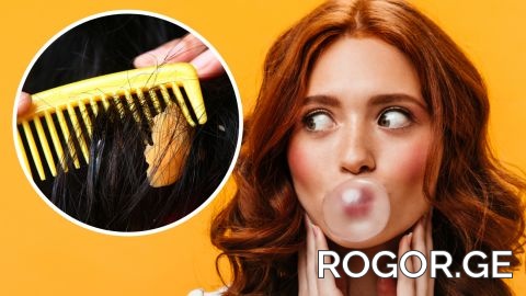 როგორ მოვიშოროთ თმიდან საღეჭი რეზინი - rogor.ge